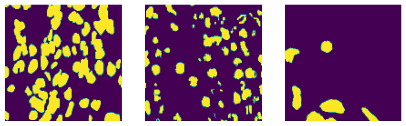 GitHub - deenazati08/Nuclei_Image_Segmentation
