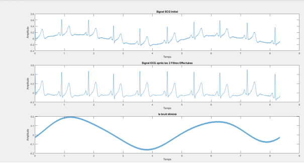 GitHub - fatimaezzahraa12/Rapport-TP2-Traitement-de-signal