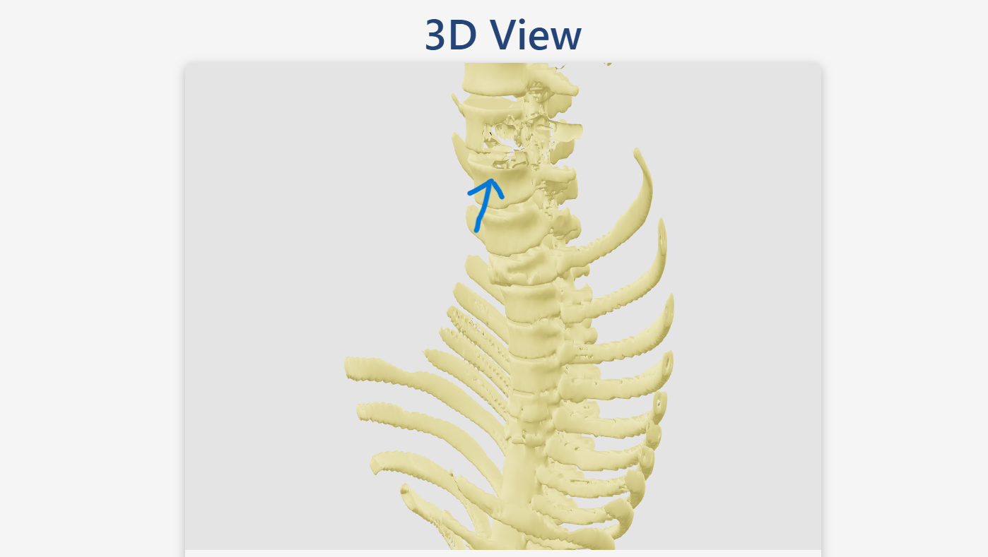 Improper rendering of Spine 3D (showing broken instead of a crack) · google model-viewer ...