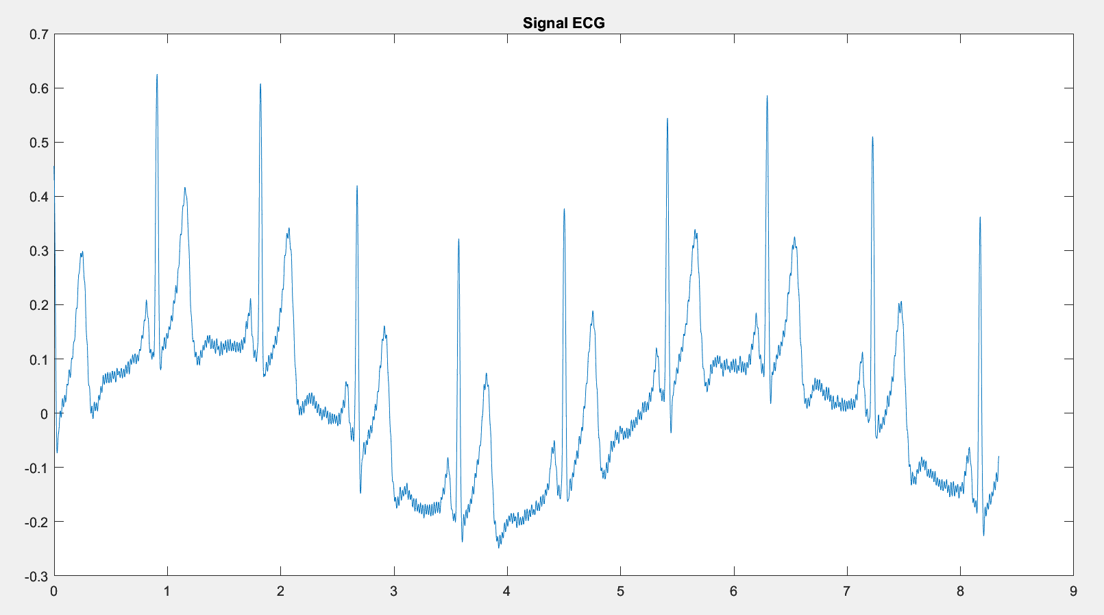 GitHub - zineb-212/TP3--Traitement-d-un-signal-ECG