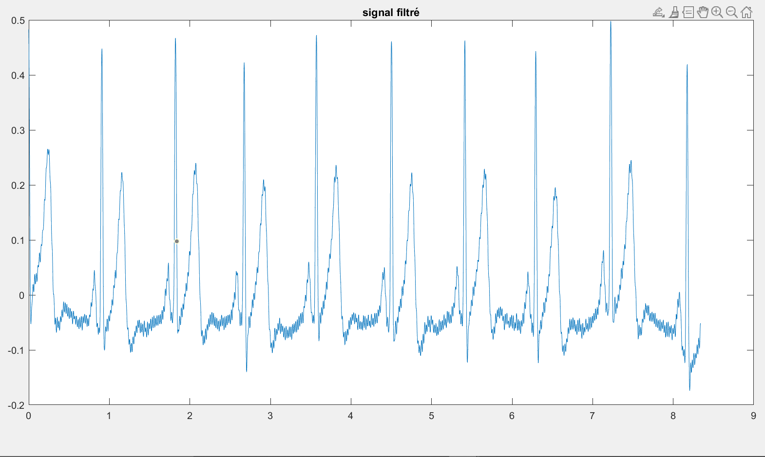 GitHub - zineb-212/TP3--Traitement-d-un-signal-ECG