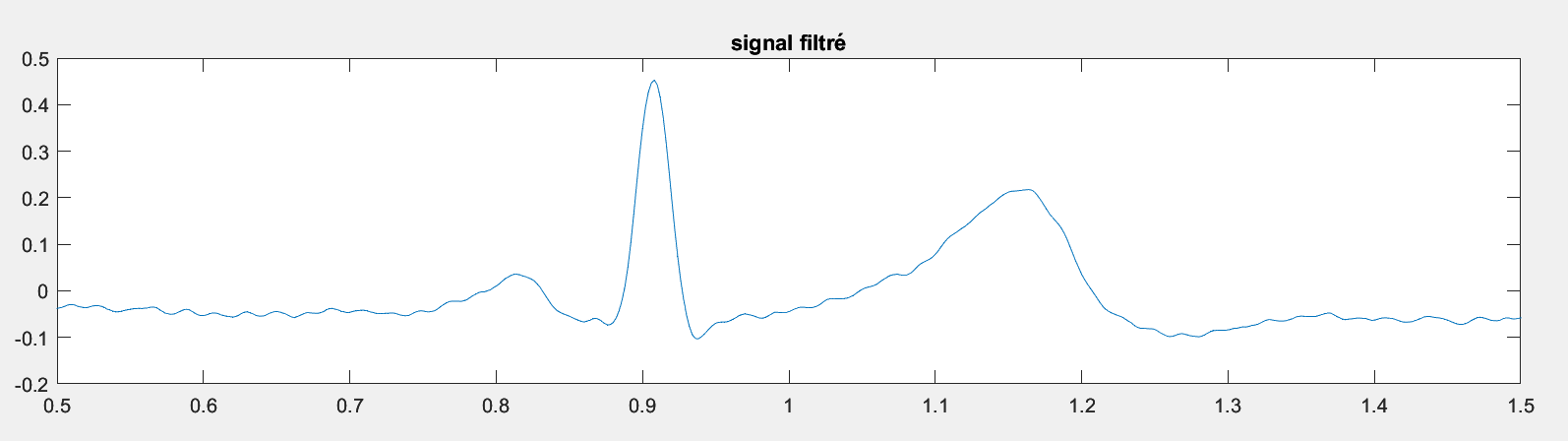 GitHub - zineb-212/TP3--Traitement-d-un-signal-ECG
