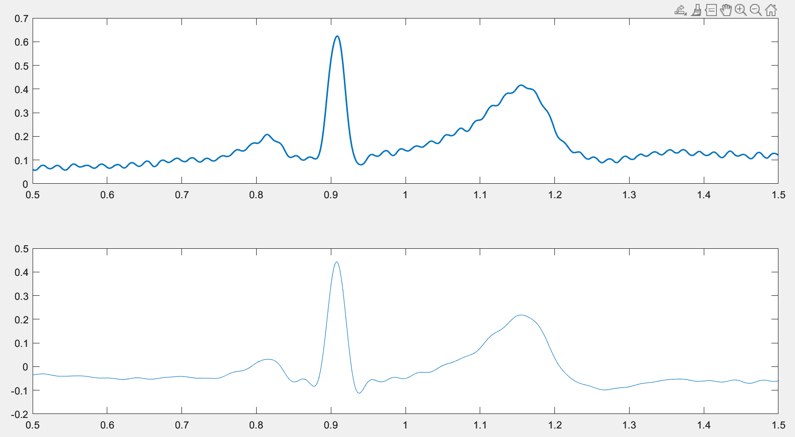 GitHub - zineb-212/TP3--Traitement-d-un-signal-ECG
