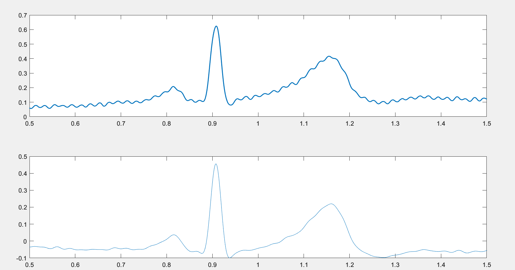 GitHub - zineb-212/TP3--Traitement-d-un-signal-ECG