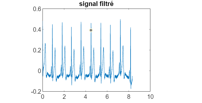 GitHub - AMRANINEJJARTasnime/TP3---Traitement-d-un-signal-ECG