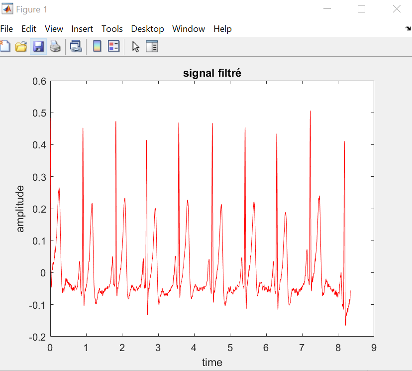 GitHub - AMRANINEJJARTasnime/TP3---Traitement-d-un-signal-ECG