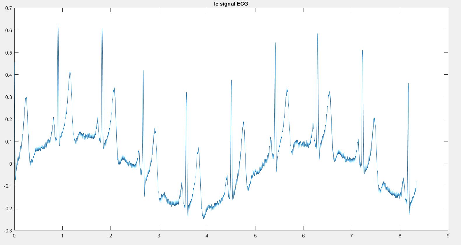 GitHub - ElMidaouiImane/TP3-Traitement-de-signal