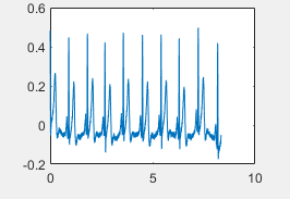 GitHub - NhailaSara/TP3_Traitement_d_un_signal_ECG