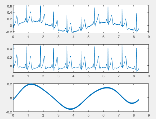 GitHub - NhailaSara/TP3_Traitement_d_un_signal_ECG