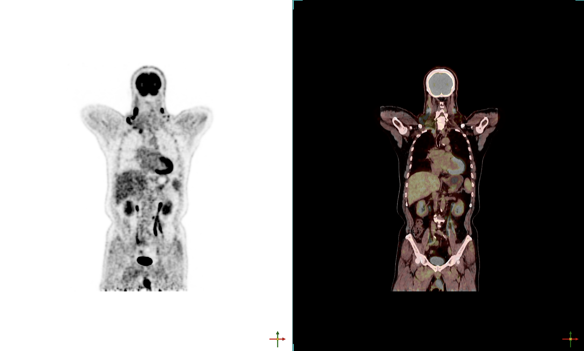 How to rescale PT, CT and Fusion series to look the same