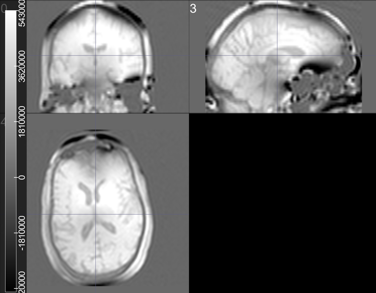 How to extract the magnitude and phase images from nifti file? · Issue ...