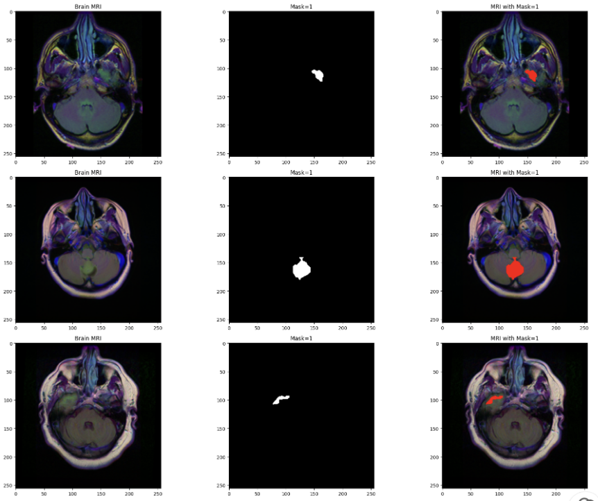 04/30 치매 MRI 이미지 확인 · Issue #1 · yu-hyun2/Transcription · GitHub