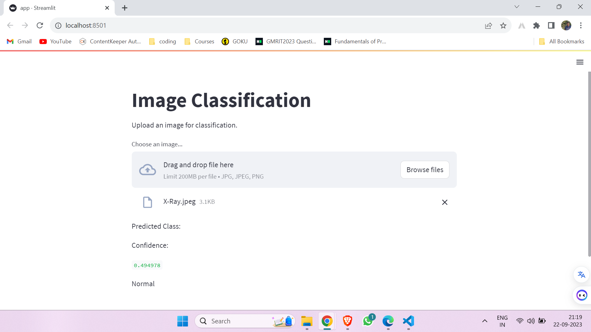 GitHub - Kousikjami/Tuberculosis_Identification
