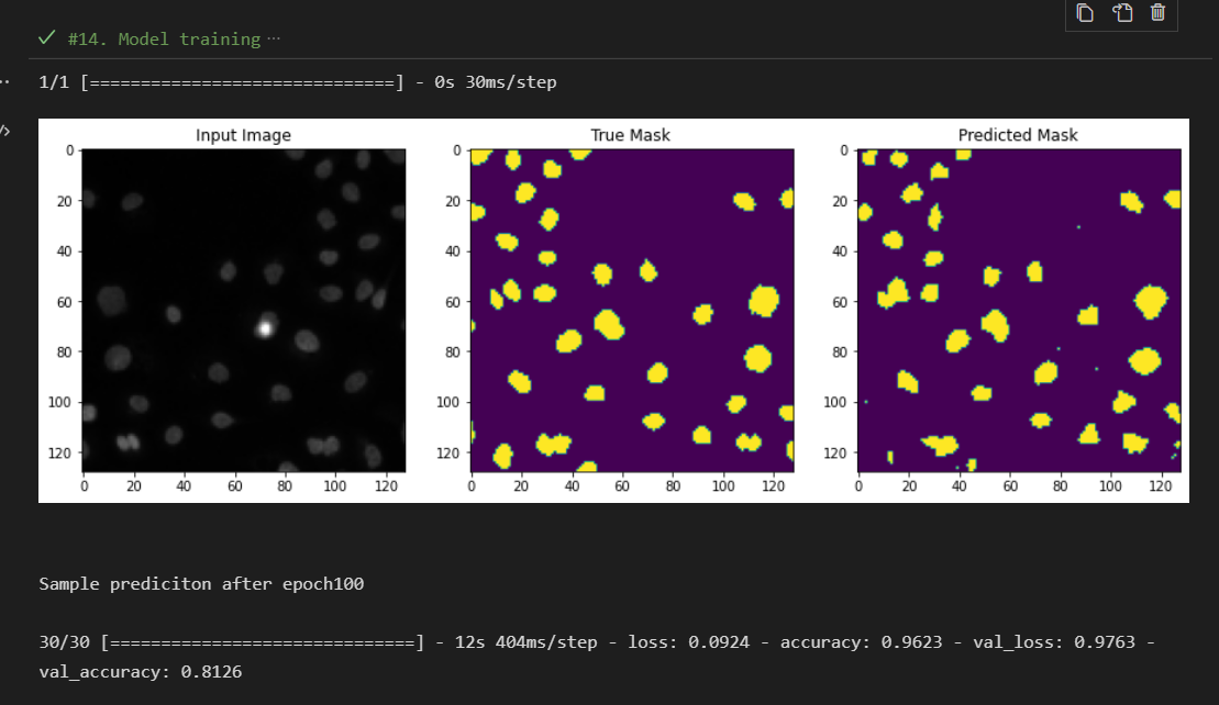 GitHub - zhengyi6534/Nuclei-detection