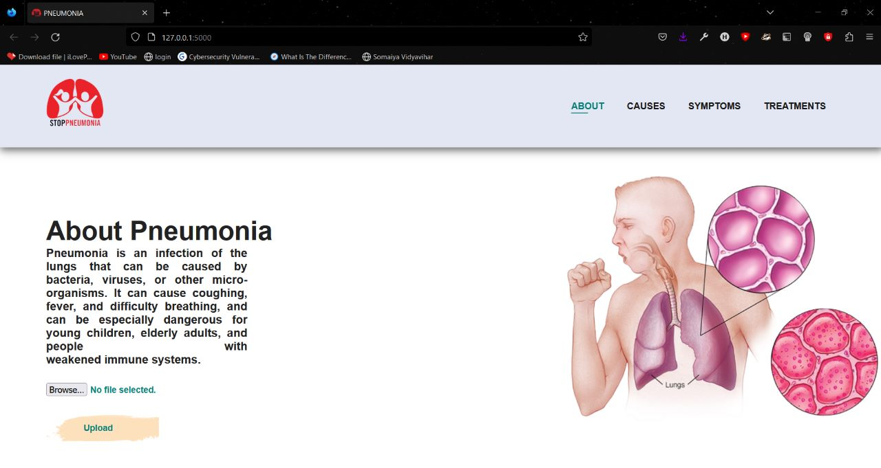GitHub - Harshalljain/Pneumonia-