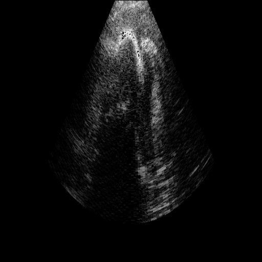 Onnx Imported Model Fails With Assertion On Forward · Issue 20681 · Opencvopencv · Github