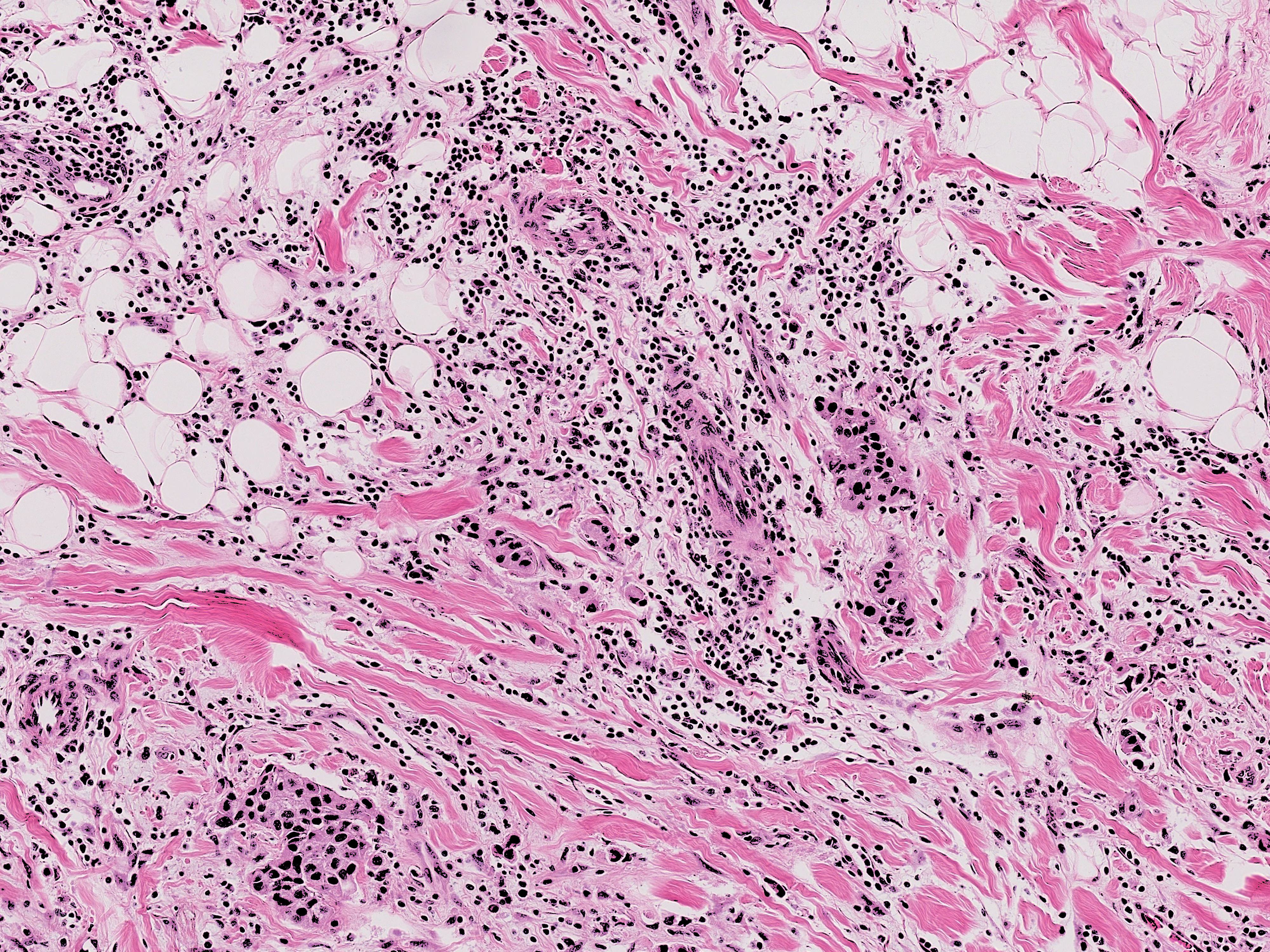 GitHub - lisalcarr/TILseg_Project2024