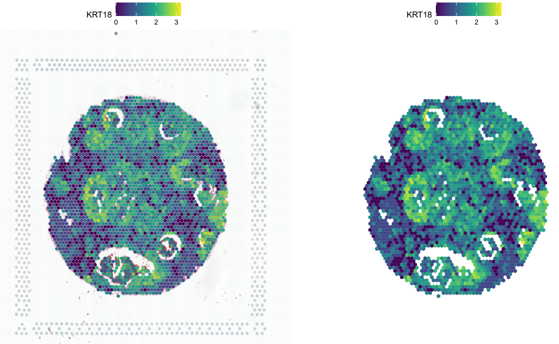 GitHub - Biocxifu/SpotSweeper: Estimate the immune cell infiltration score of adjacent stromal ...