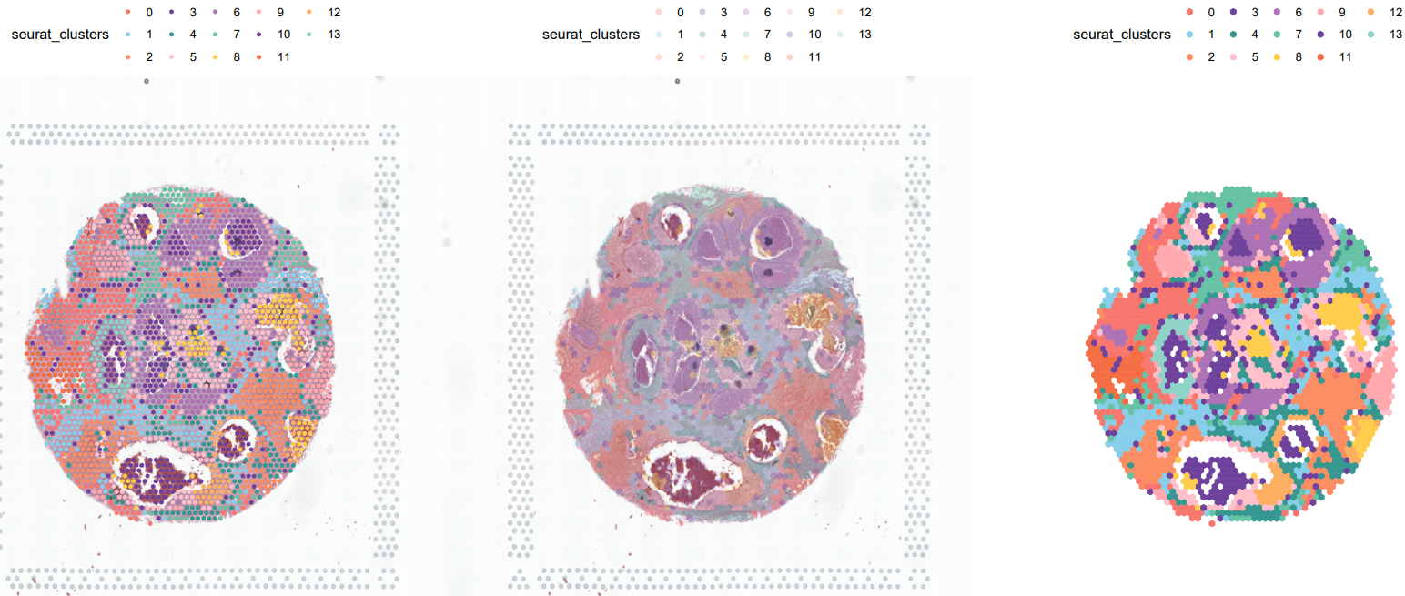 GitHub - Biocxifu/SpotSweeper: Estimate the immune cell infiltration score of adjacent stromal ...