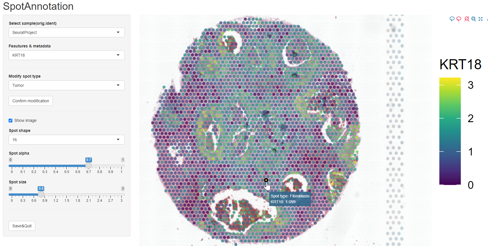 GitHub - Biocxifu/SpotSweeper: Estimate the immune cell infiltration score of adjacent stromal ...