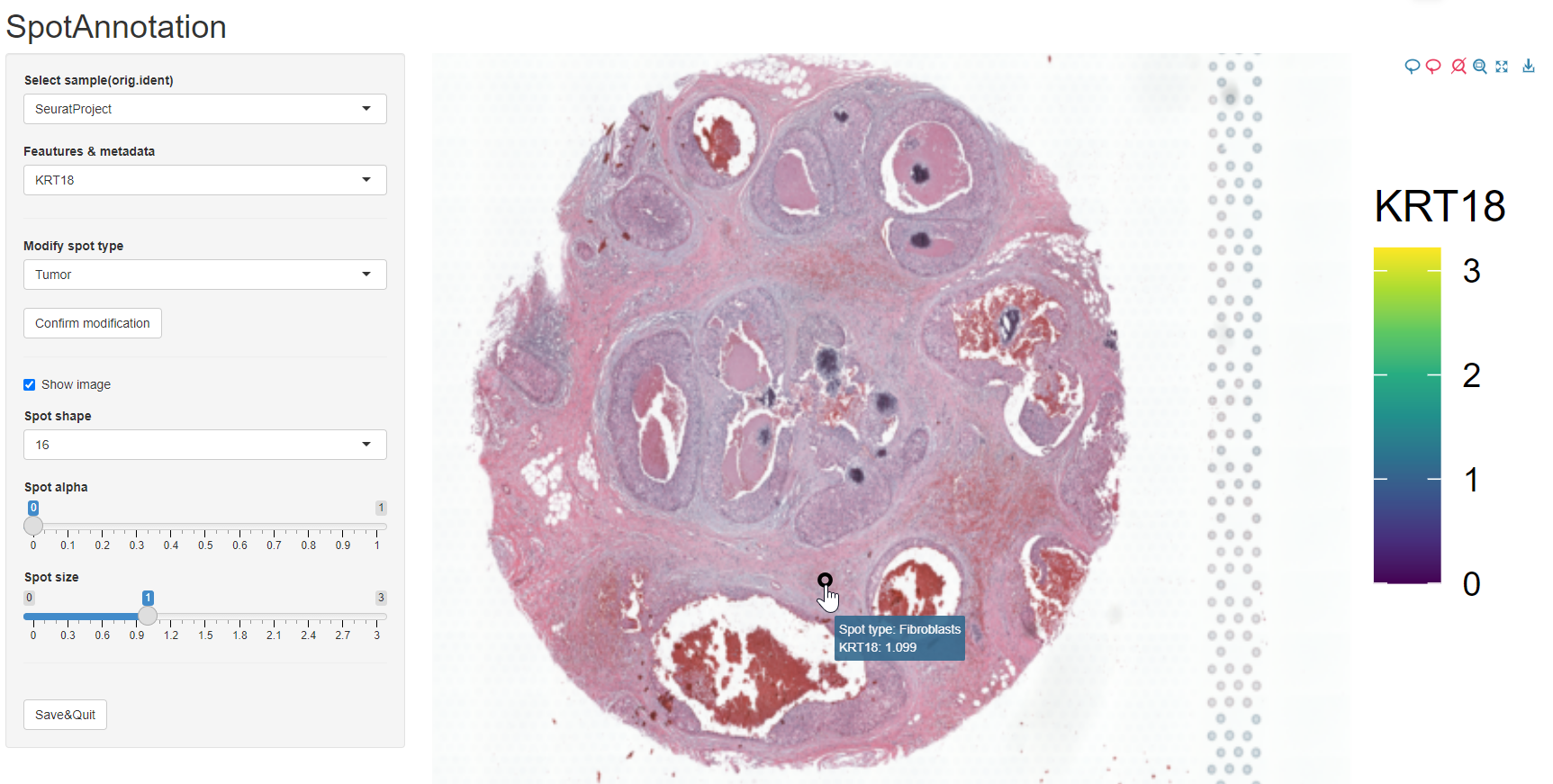 GitHub - Biocxifu/SpotSweeper: Estimate the immune cell infiltration score of adjacent stromal ...