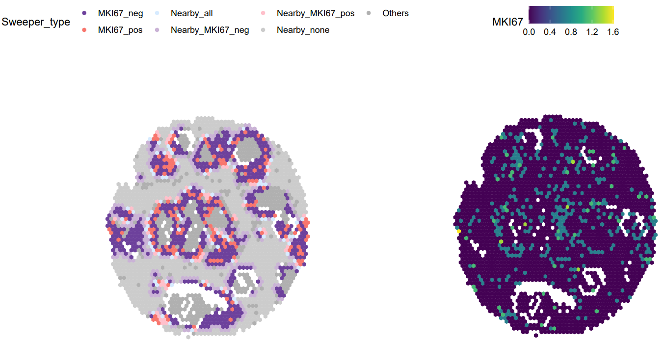 GitHub - Biocxifu/SpotSweeper: Estimate the immune cell infiltration score of adjacent stromal ...