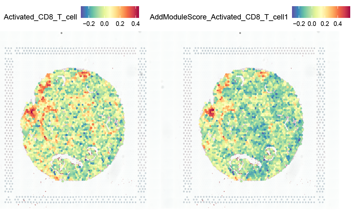 GitHub - Biocxifu/SpotSweeper: Estimate the immune cell infiltration ...