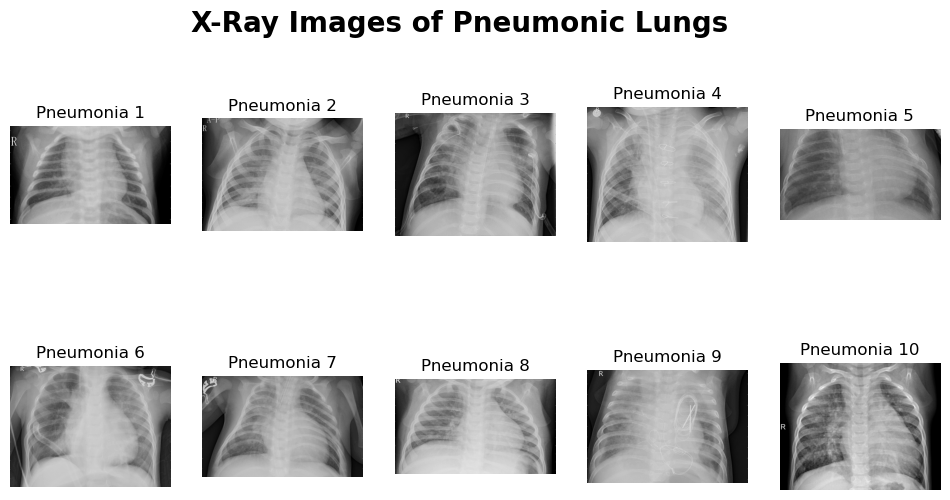 GitHub - jaeheonk817/project-5__pneumonia-detection: This is my first deep learning project ...