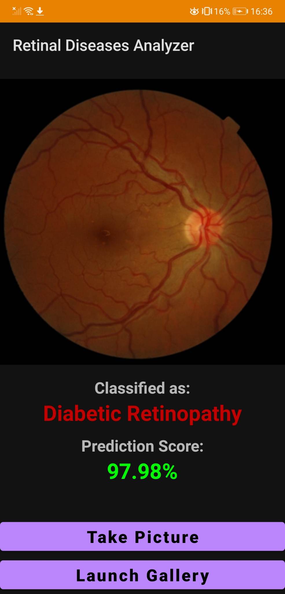 GitHub - jackaquamin/4-classes-retinal-diseases-classification ...