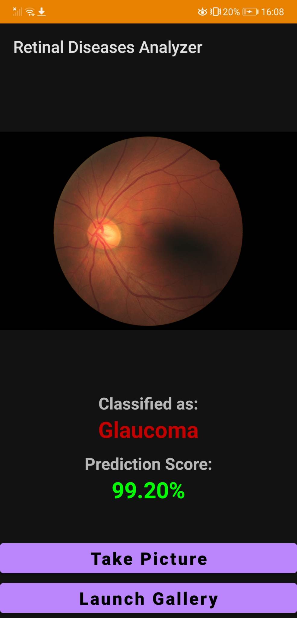GitHub - jackaquamin/4-classes-retinal-diseases-classification ...