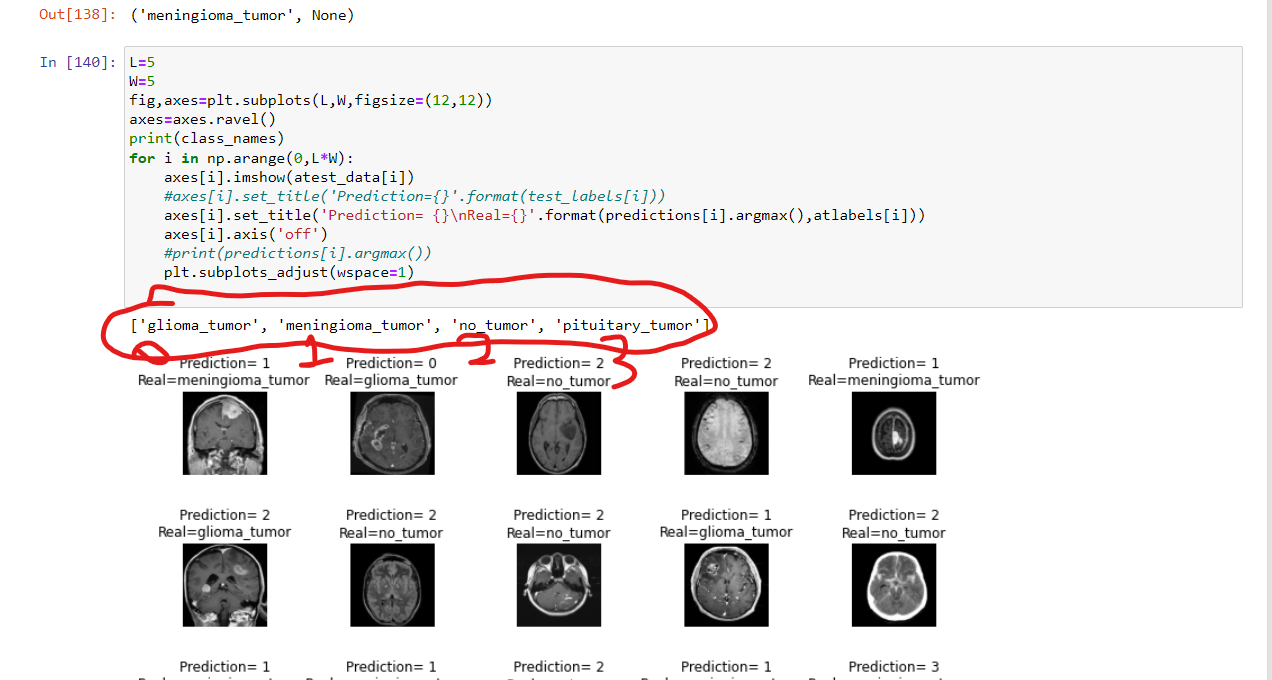GitHub - omrbhdr/brain-tumor-cnn