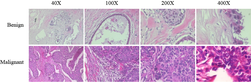 GitHub - imashoodnasir/Breast-Cancer-Classification-for ...