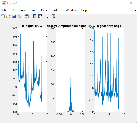 GitHub - hassnaao/tp-traitement-de-signal