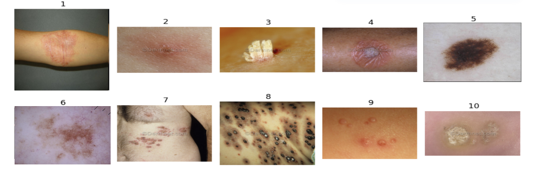 GitHub - ovobb/zerobase_DL_project