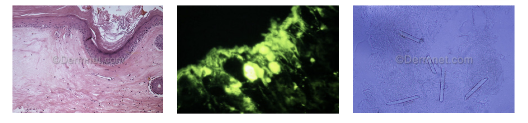 GitHub - ovobb/zerobase_DL_project