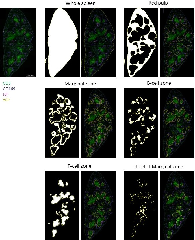 GitHub - Imagimm-CIML/Micro-anatomical-location-of-splenic-IFNpos-vs ...
