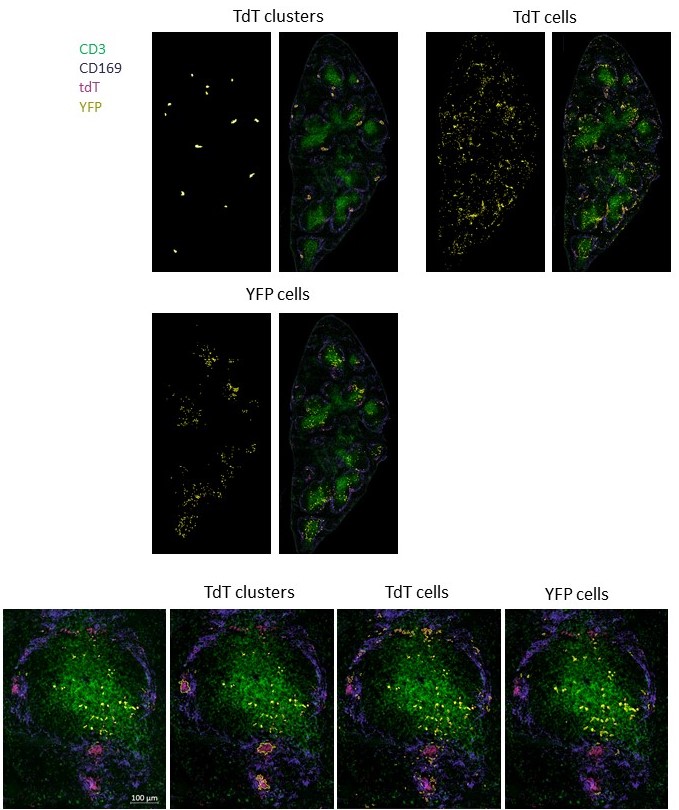 GitHub - Imagimm-CIML/Micro-anatomical-location-of-splenic-IFNpos-vs ...