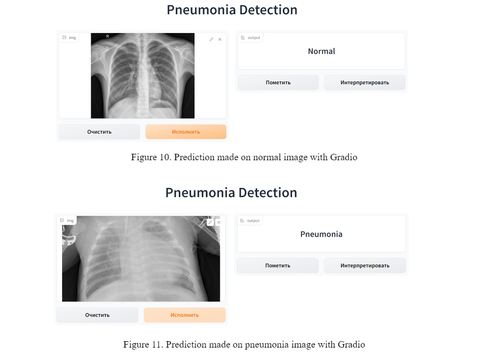 GitHub - zhvmdn/Pneumonia_Detection