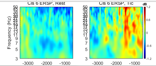 ERSP plot mismatch in eeglab2021 vs eeglab14 · Issue #389 · sccn/eeglab · GitHub
