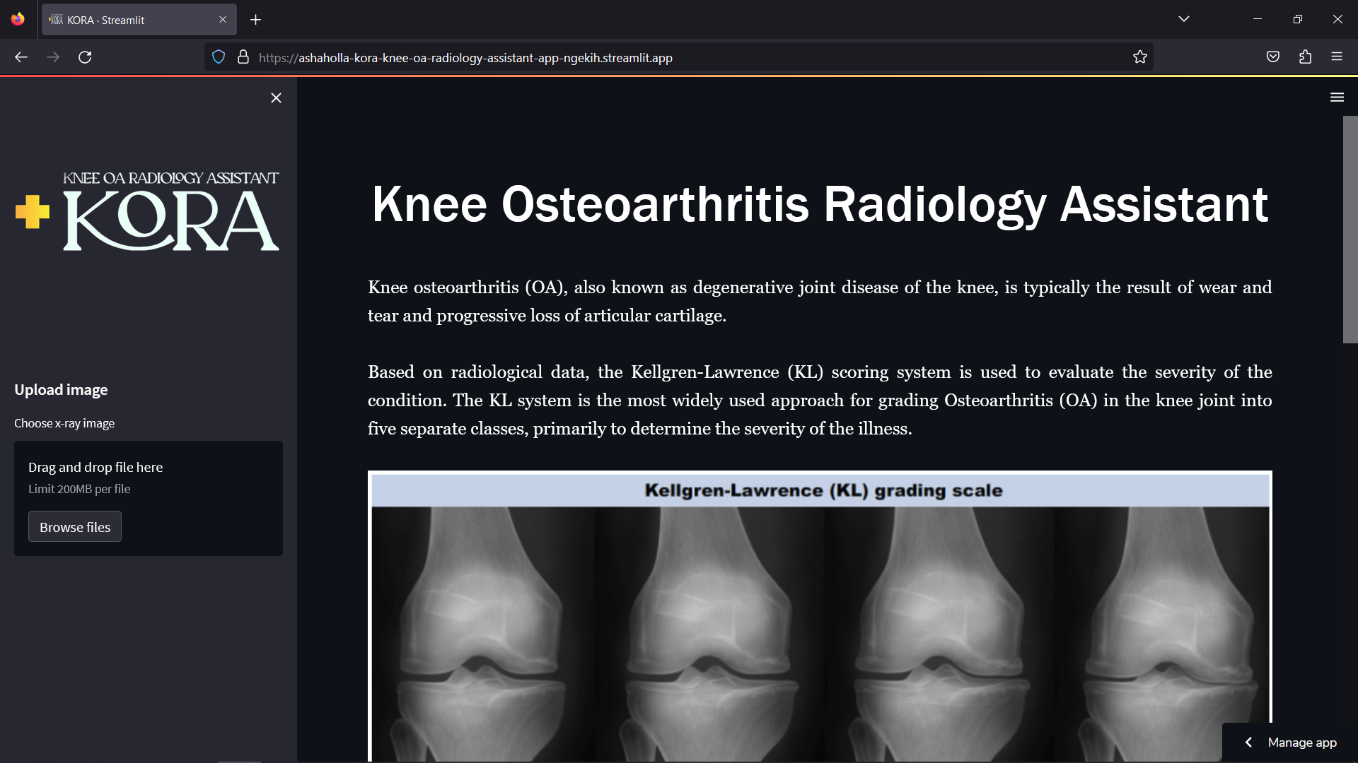 GitHub - AshaHolla/KORA-Knee-OA-radiology-Assistant: KORA is an online webservice which aims to ...