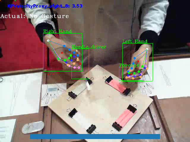 Hand-Pose-Estimation-For-Surgical-Training/surgical-landmarks/README.md ...