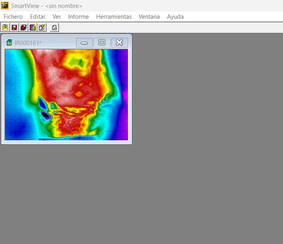GitHub - Eitonan/thermical_image_analysis: Allows you to make a ...