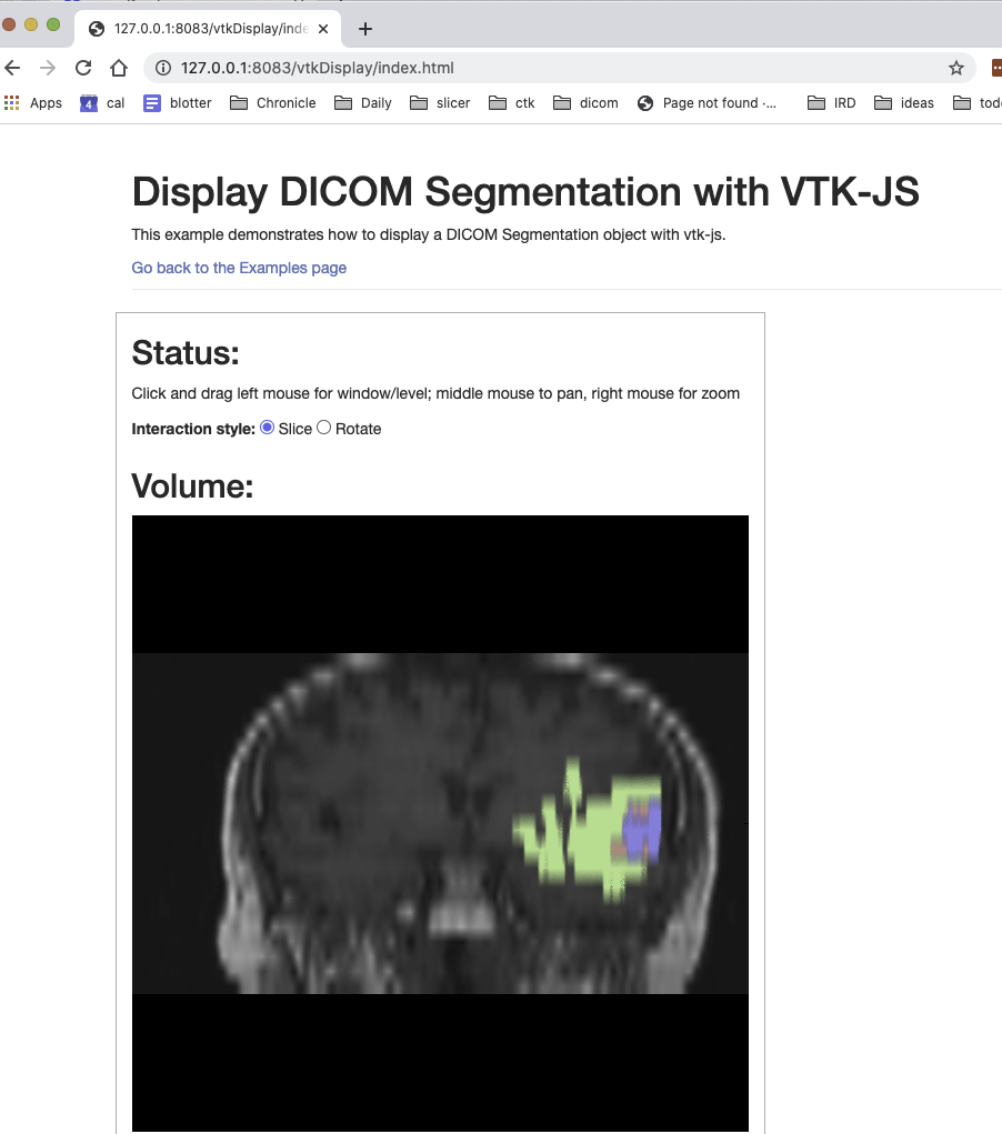 Incorrect Orientation For Displayed Seg Overlay · Issue 2003 · Ohifviewers · Github 