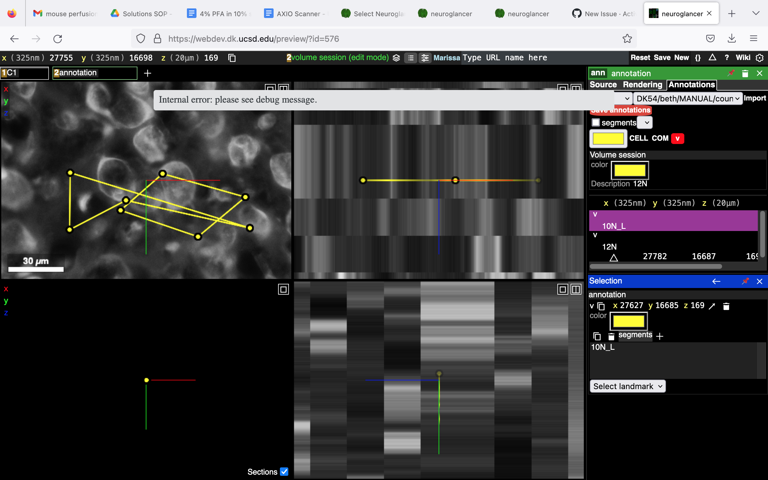 "Save annotations" button is not working · Issue #146 · ActiveBrainAtlas2/activebrainatlasadmin ...