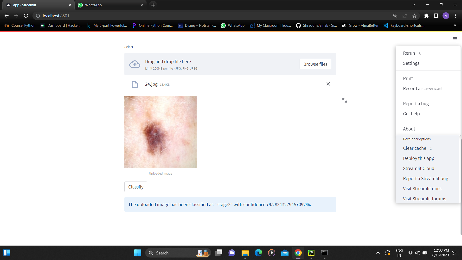 GitHub - AniruddhaChitte/Melanoma-Skin-Cancer-Stage-Detection