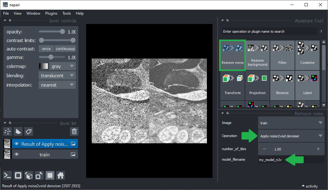 Interoperability With Napari Workflows Napari Assistant · Issue 6 · Juglab Napari N2v · Github