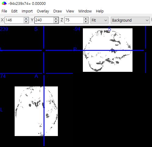 How to postprocess ensembled new models? · Issue #1605 · MIC-DKFZ ...