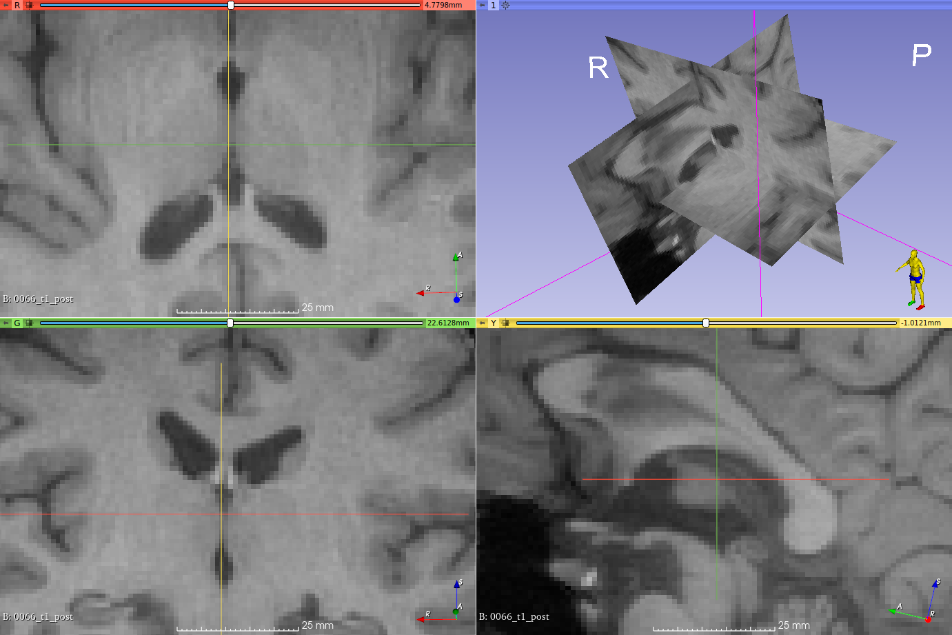 Make slice views aligned with image axes by default · Issue #5379 ...