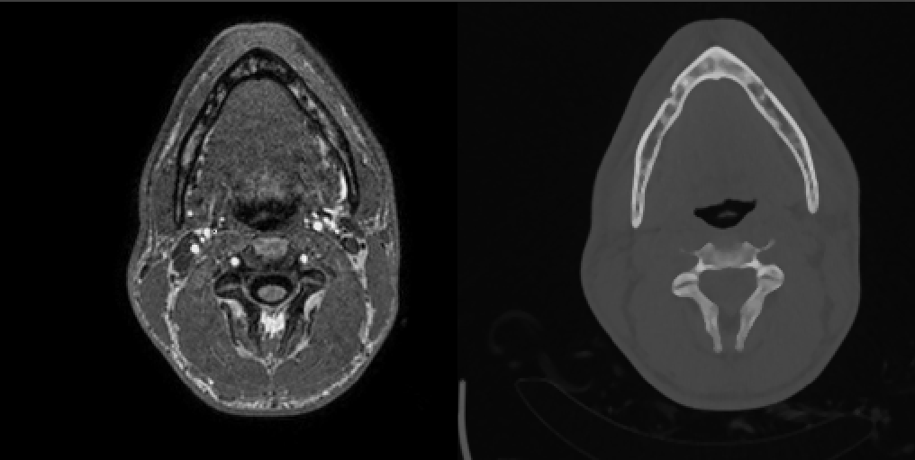 Loading pix2pix generator and inferring · Issue #1314 · junyanz/pytorch ...