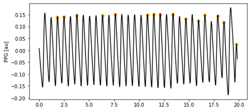 GitHub - RikinBasu/PPG-signal-to-detect-an-elevated-shock-index: The ...
